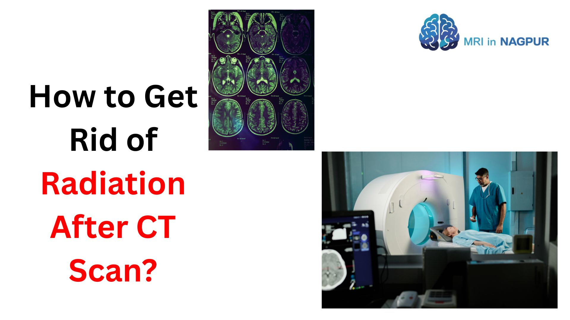 How to Get Rid of Radiation After CT Scan - 2025 Report