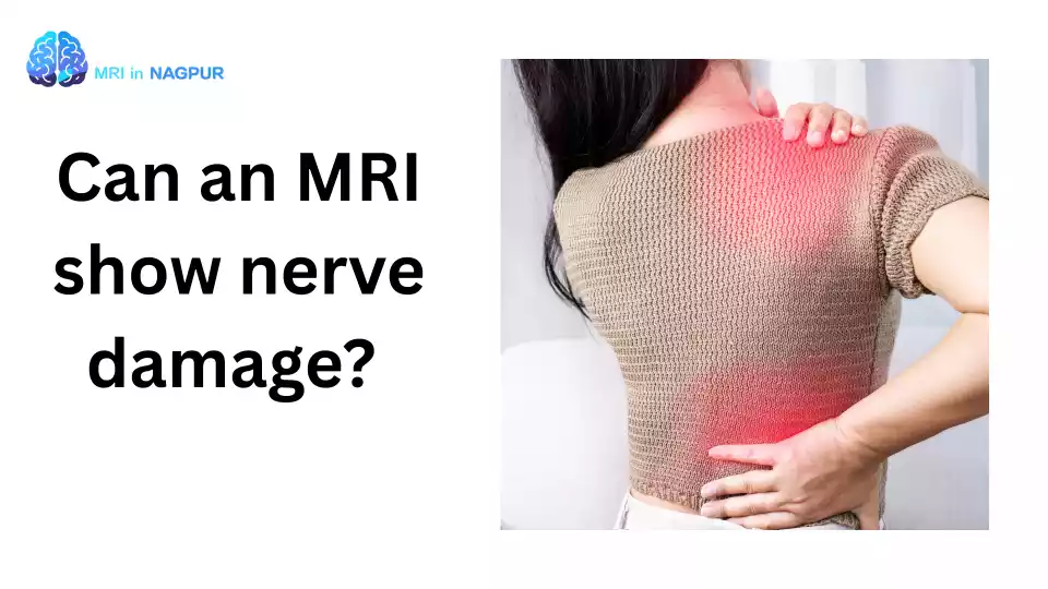 Can an MRI show nerve damage? - Nagpur MRI Scan