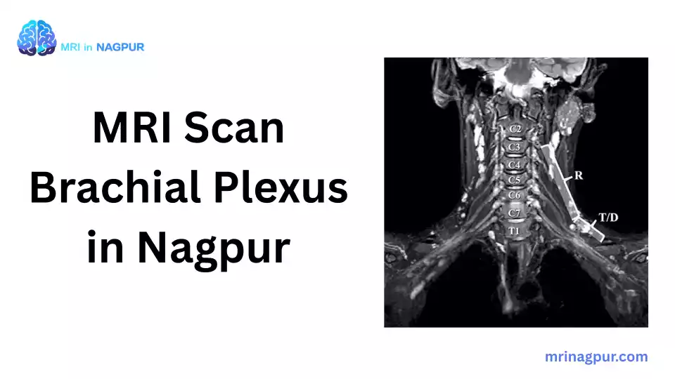 MRI Scan Brachial Plexus in Nagpur - Nagpur MRI Scan
