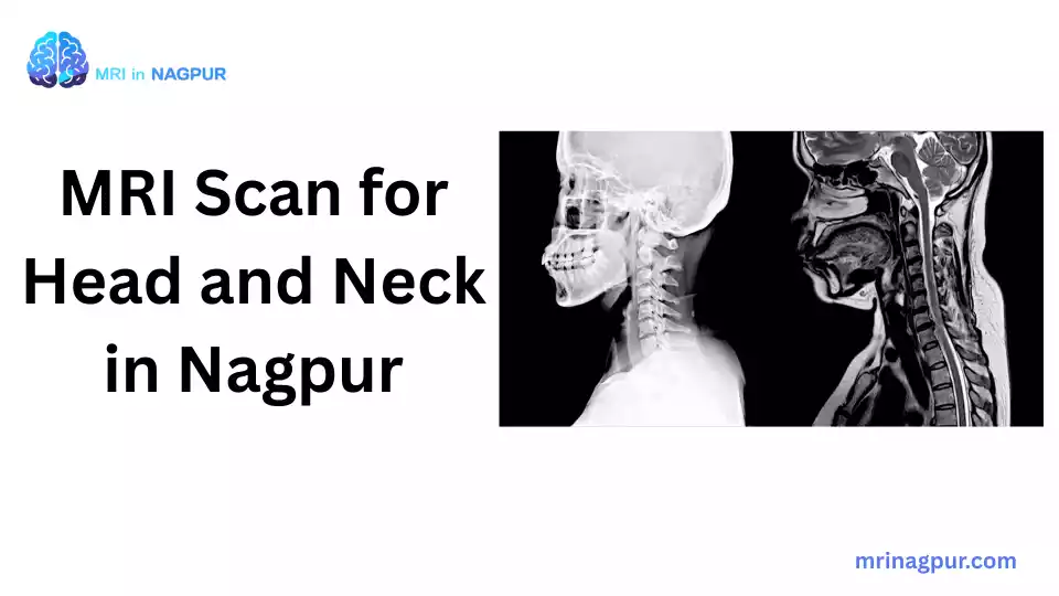 MRI Scan for Head and Neck in Nagpur - Nagpur MRI Scan