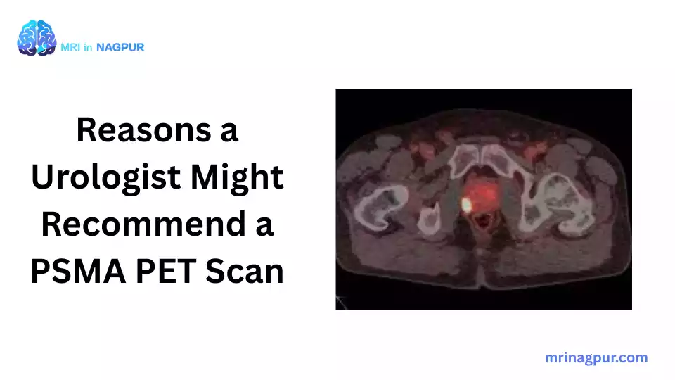 Why Would a Urologist Order a PSMA PET scan - Nagpur MRI Scan